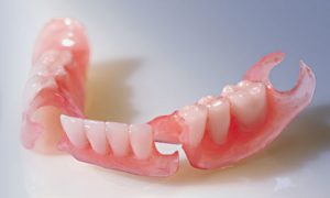 Flexible Prothetik | RAB - Zahntechnik Labor GmbH